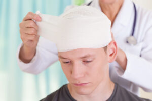 Blunt Force Head Trauma: Symptoms, Treatment & Legal Options